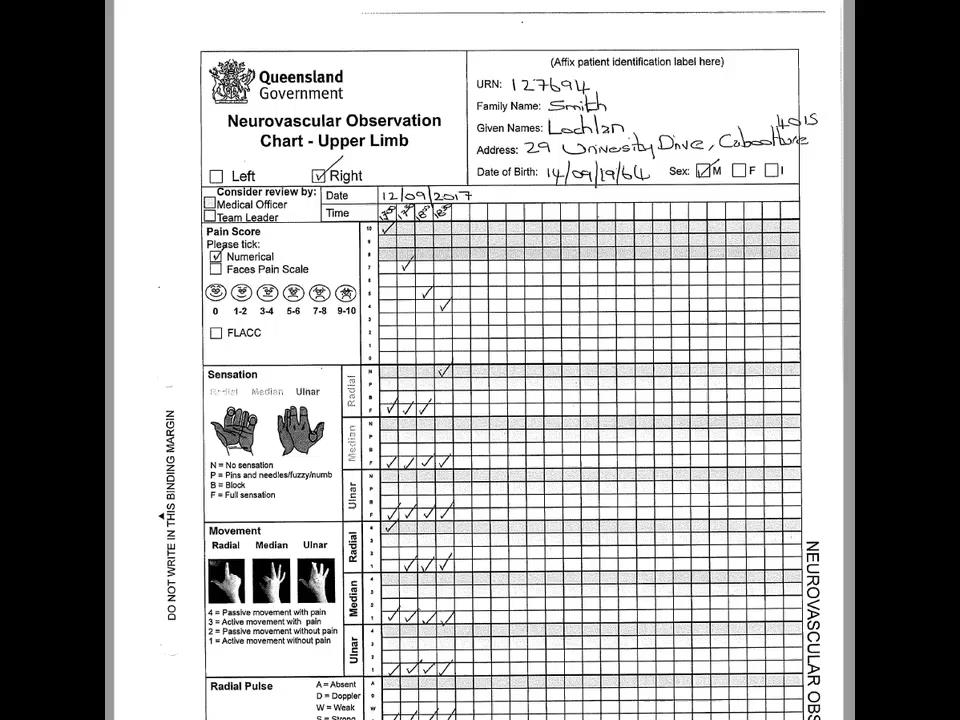 Neurovascular Observation Upper Chart